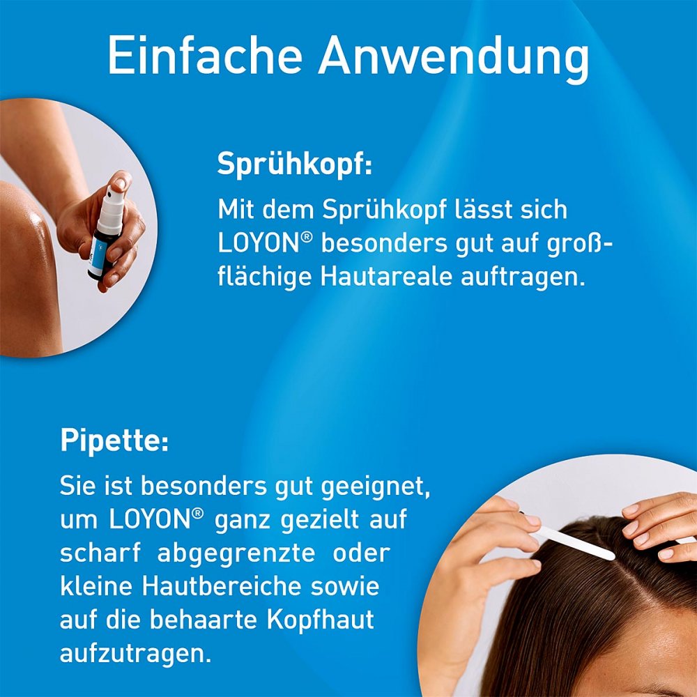 Loyon na choroby związane z łuszczącą się skórą 50 ml